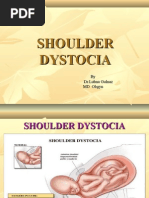 Zavanelli Maneuver for Shoulder Dystocia | PDF | Childbirth | Caesarean ...