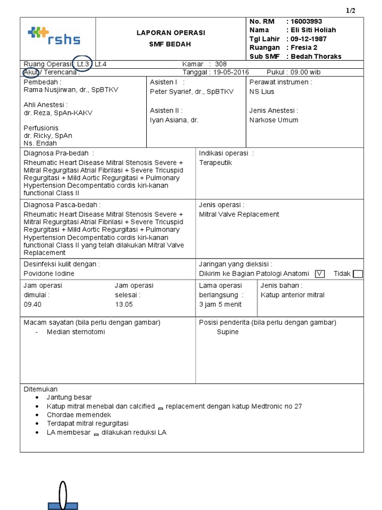 Laporan Operasi | PDF