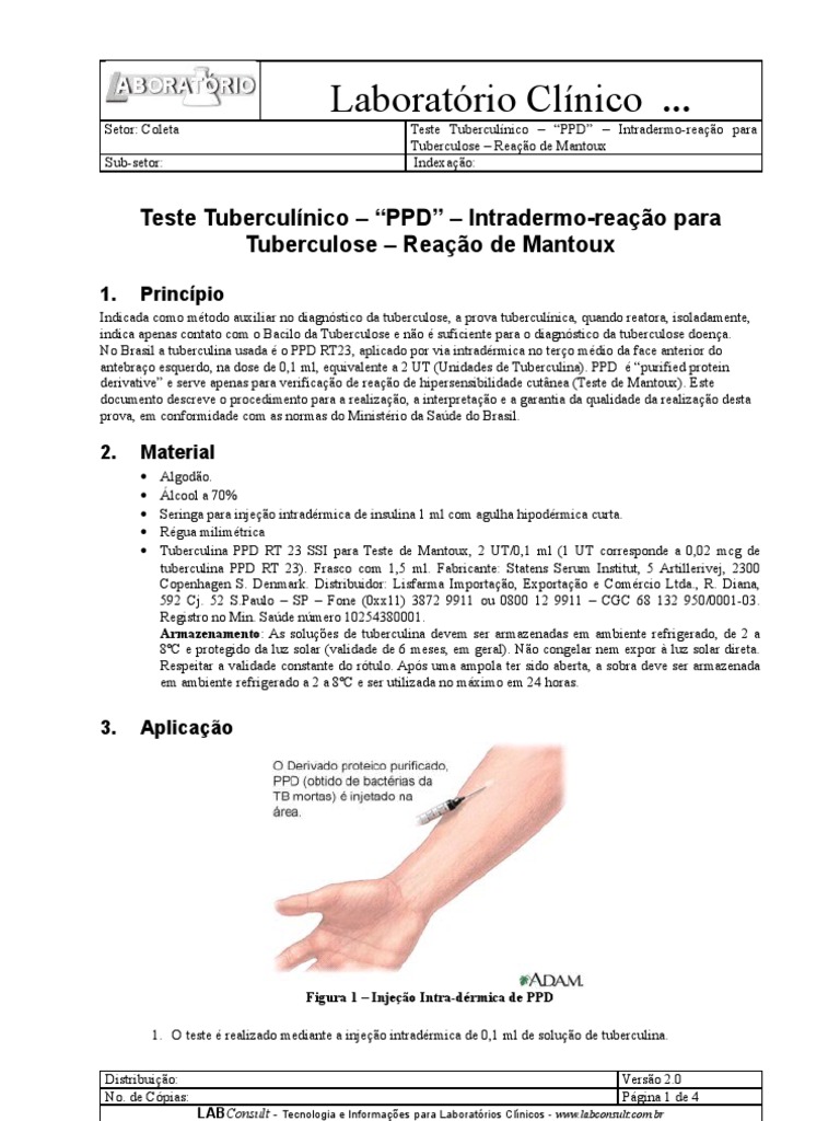 Teste Tuberculínico – “PPD” – Intradermo-reação para Tuberculose ...