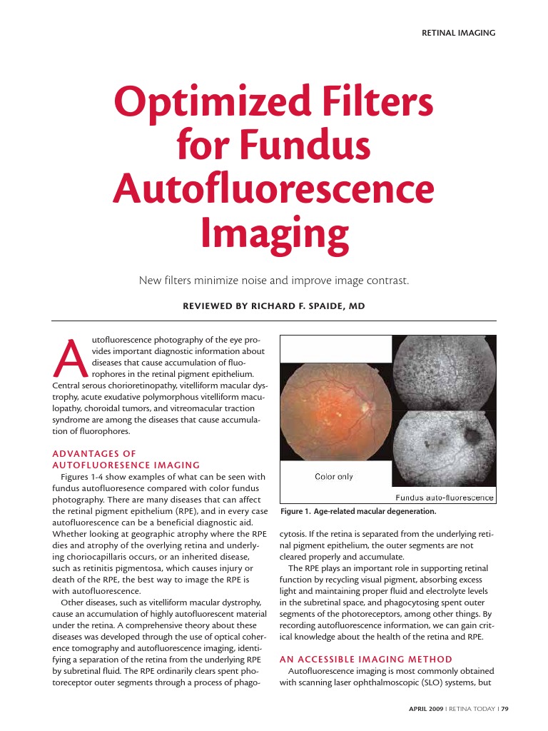 Retina Today (Filters) | PDF | Retina | Optical Filter