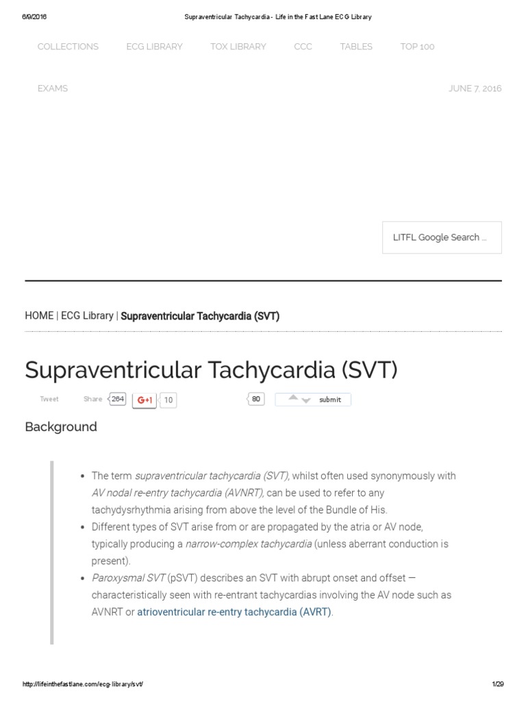 Supraventricular Tachycardia - Life in The Fast Lane ECG Library | PDF ...
