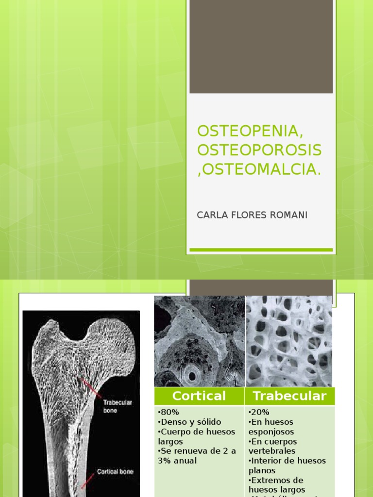 Osteopenia y osteoporosis: diagnóstico y diferencias | PDF | Hueso ...