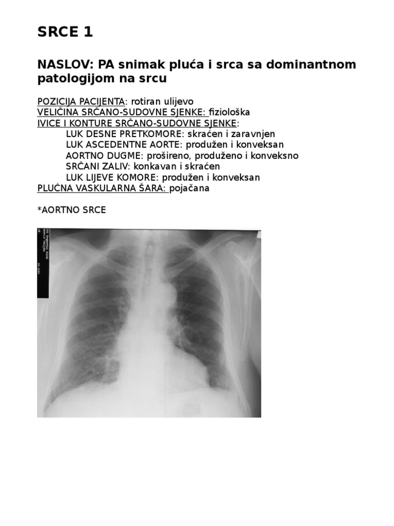 Radiologija Srce | PDF