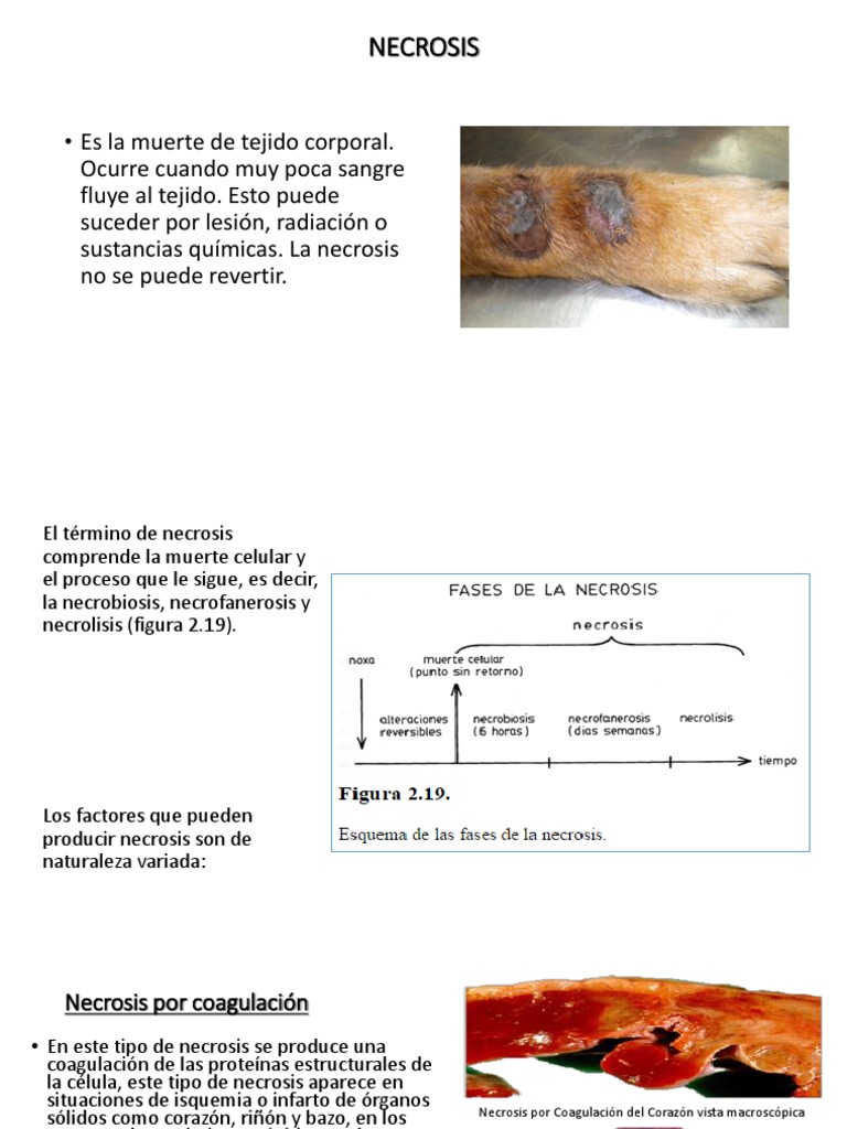 Tipos y fases de la necrosis | PDF | Necrosis | Isquemia