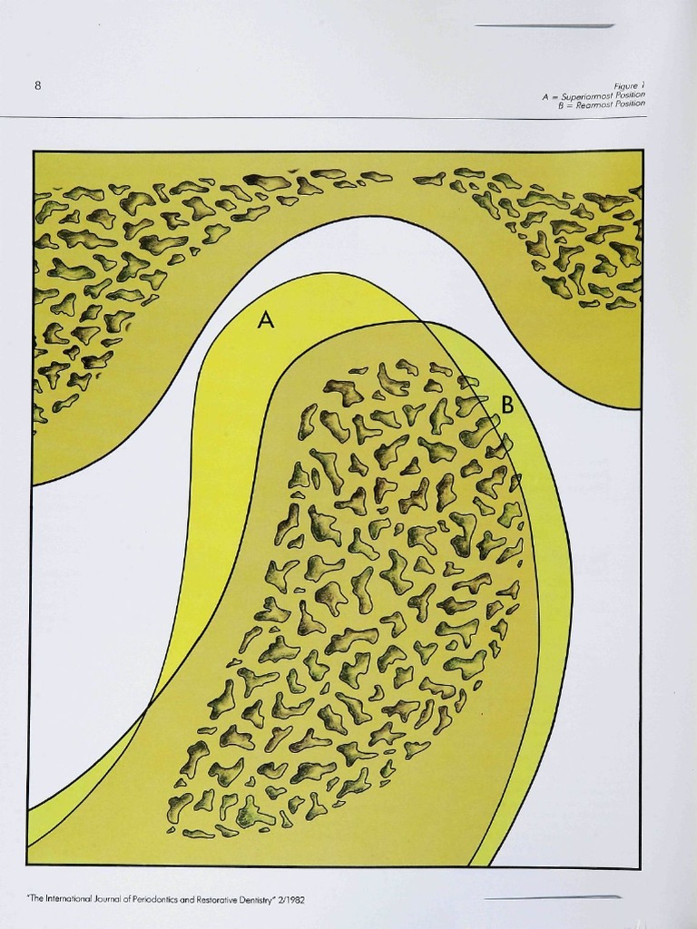 Centric Relation. The Anterior Biting Jig For Recording The Clenching ...