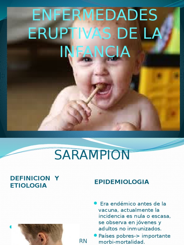 Enfermedades Eruptivas de La Infancia | PDF | Virus | Sarampión