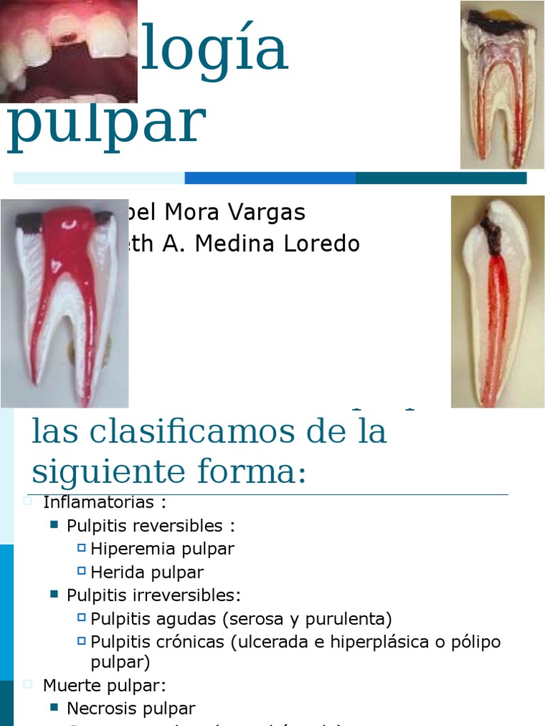 Clasificación de la Patología Pulpar | PDF | Medicina CLINICA | Medicina