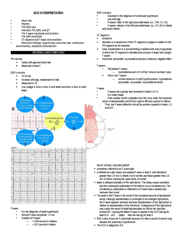 Ecg Interpretation: Intervals and Complexes | PDF | Electrocardiography ...