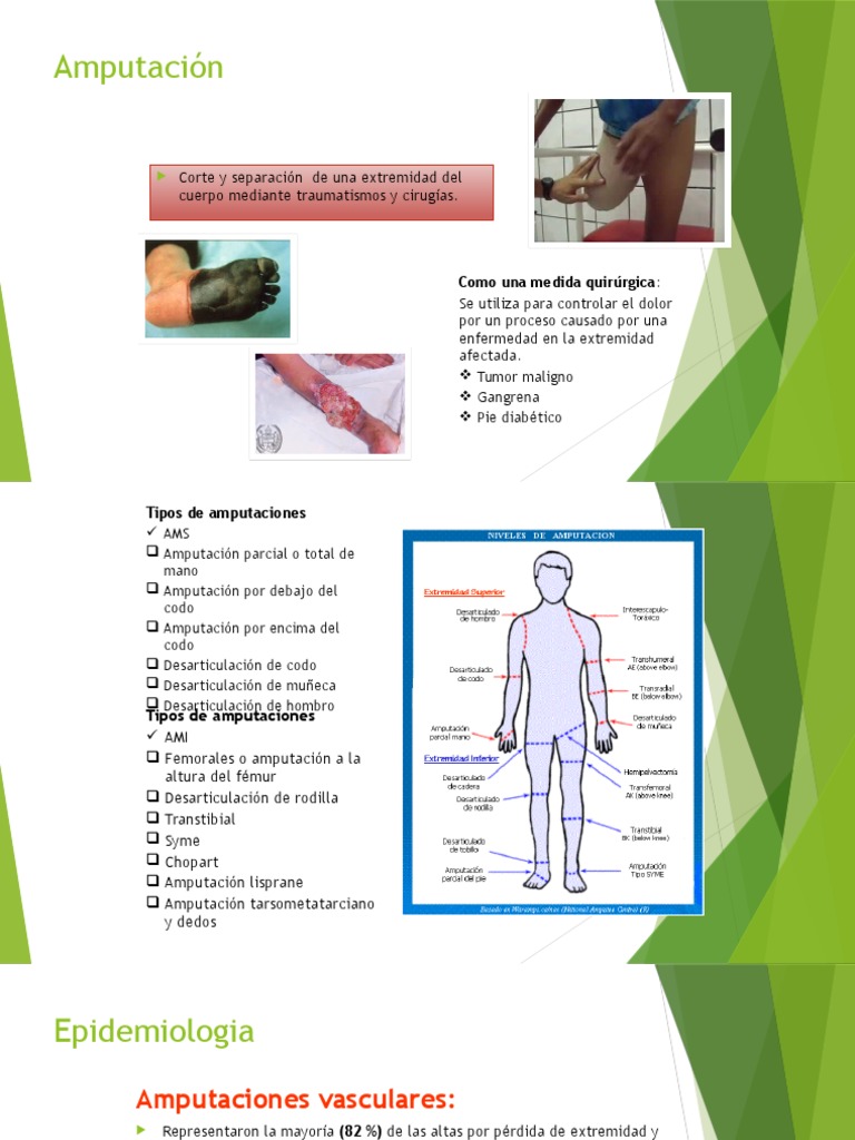 Fisioterapia y Acupuntura en Paciente Amputado | Amputación | Rodilla