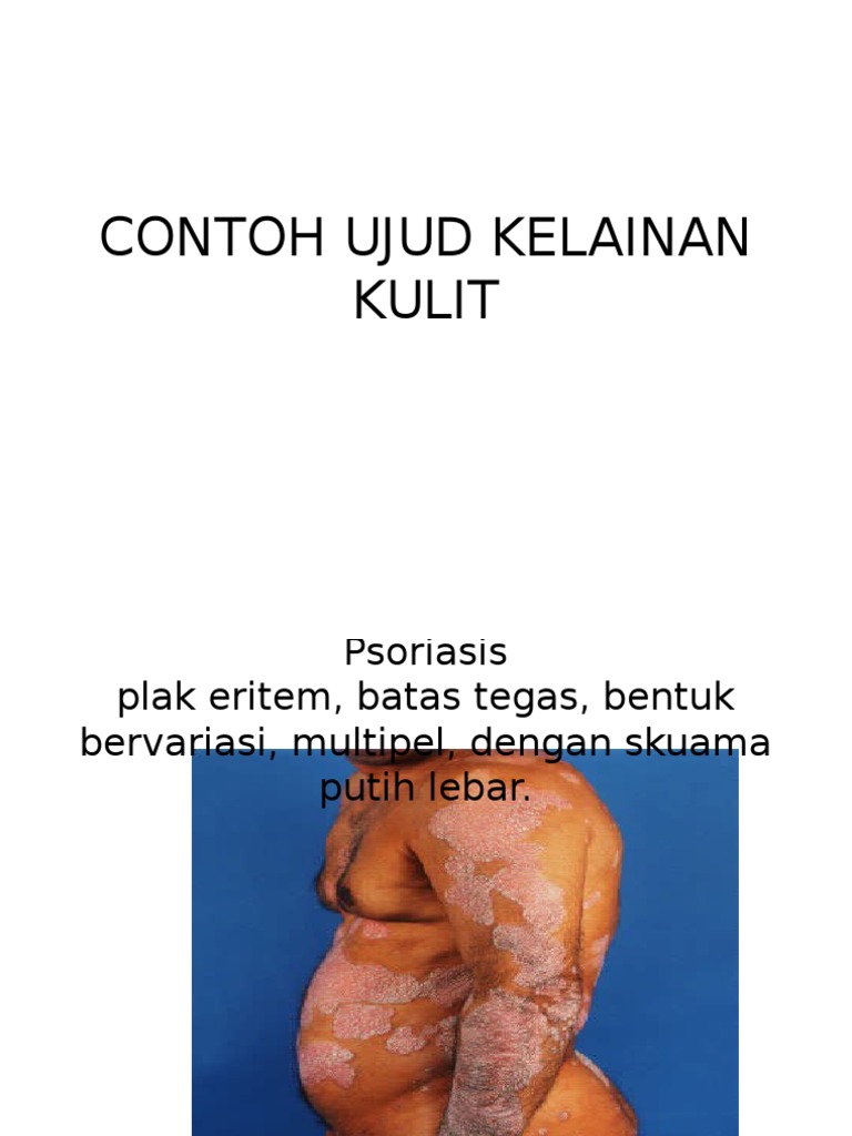 Contoh Ujud Kelainan Kulit | PDF | Cutaneous Conditions | Animal Diseases