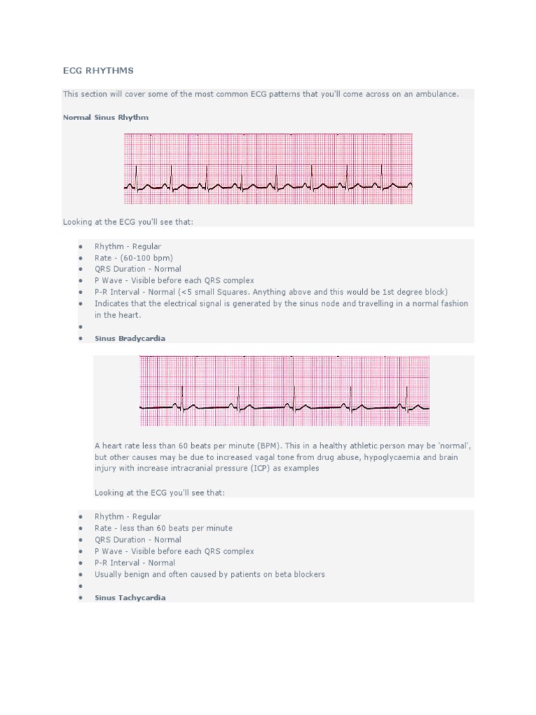 ECG Reading | PDF | Electrocardiography | Heart