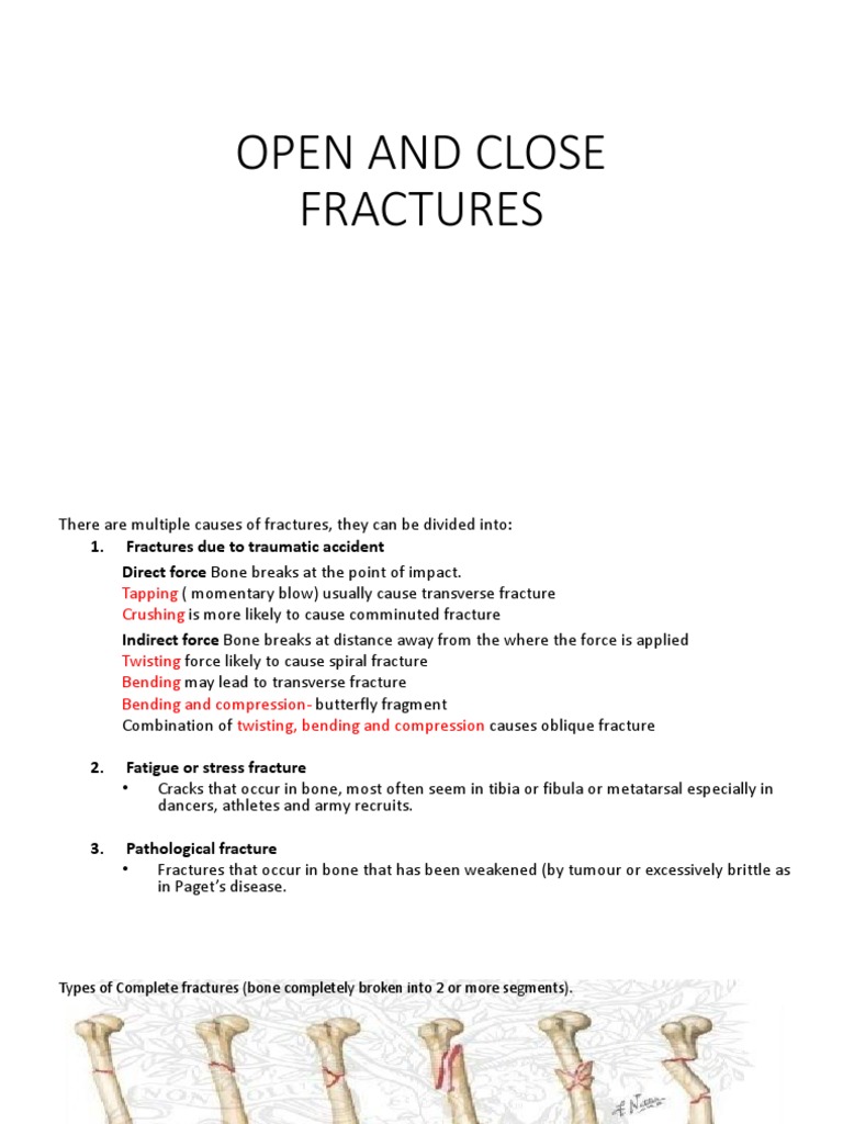 Open and Closed Fracture | PDF | Bone | Musculoskeletal System