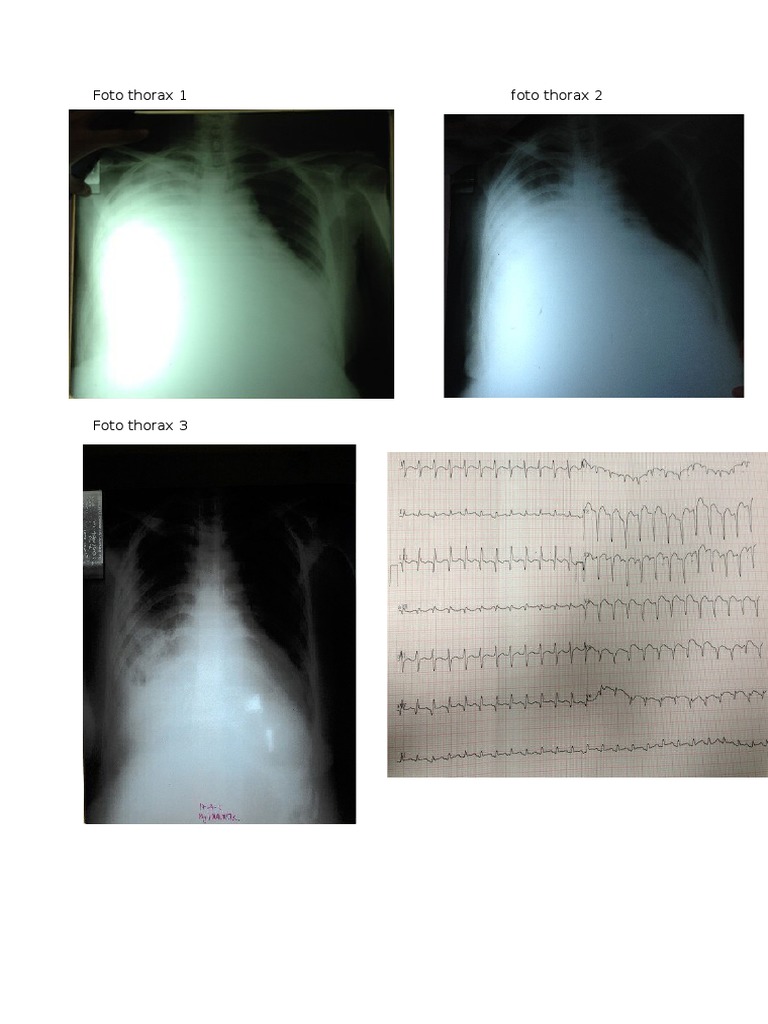 Foto Thorax 1 Foto Thorax 2 | PDF