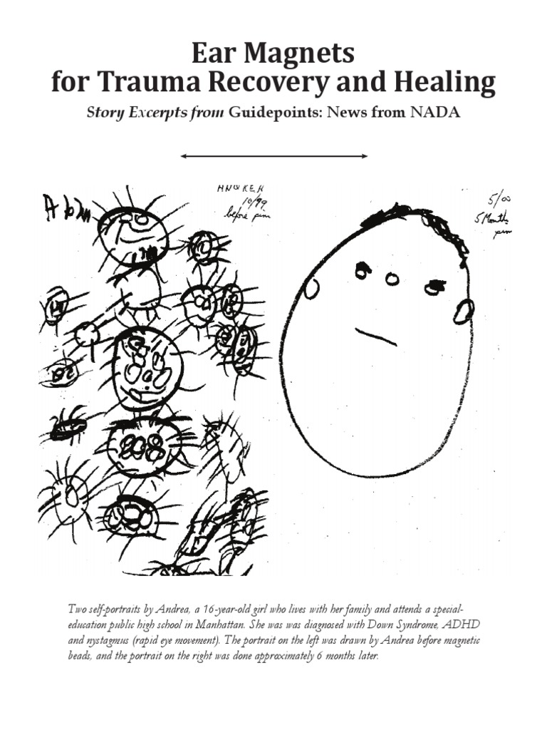 Ear Magnets For Trauma Recovery and Healing | PDF | Homelessness | Prison