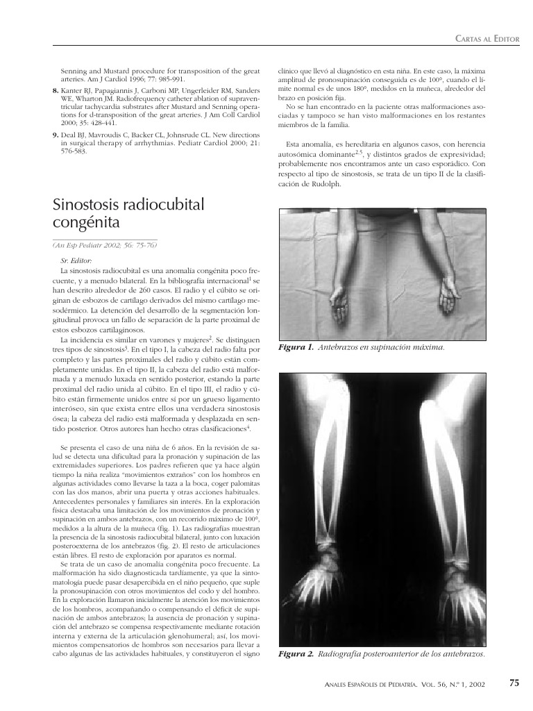 Sinostosis RCD | PDF | Extremidades (anatomía) | Sistema musculoesquelético