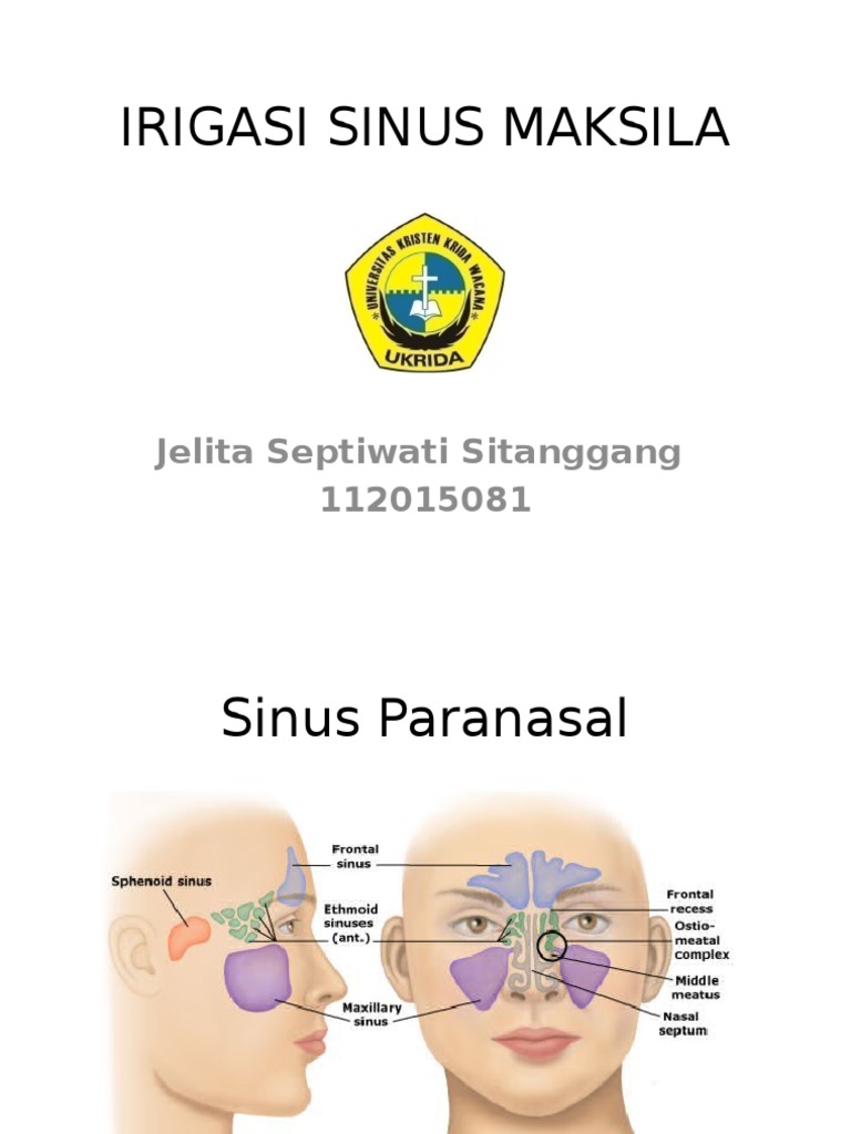 Irigasi Sinus Maksila | PDF | Sains & Matematika