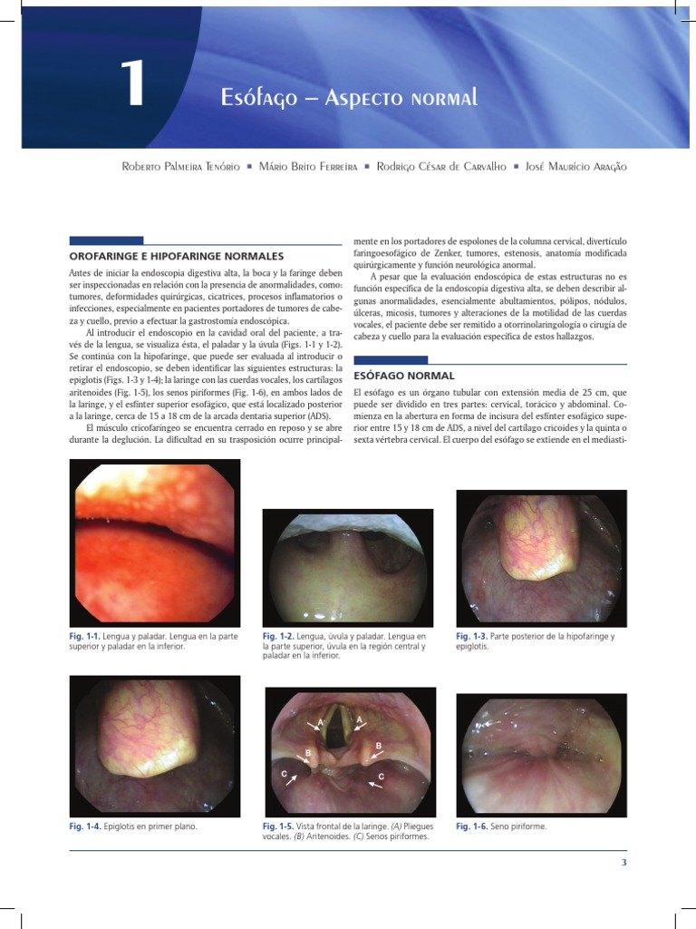 Endoscopias | PDF | Estómago | Esófago