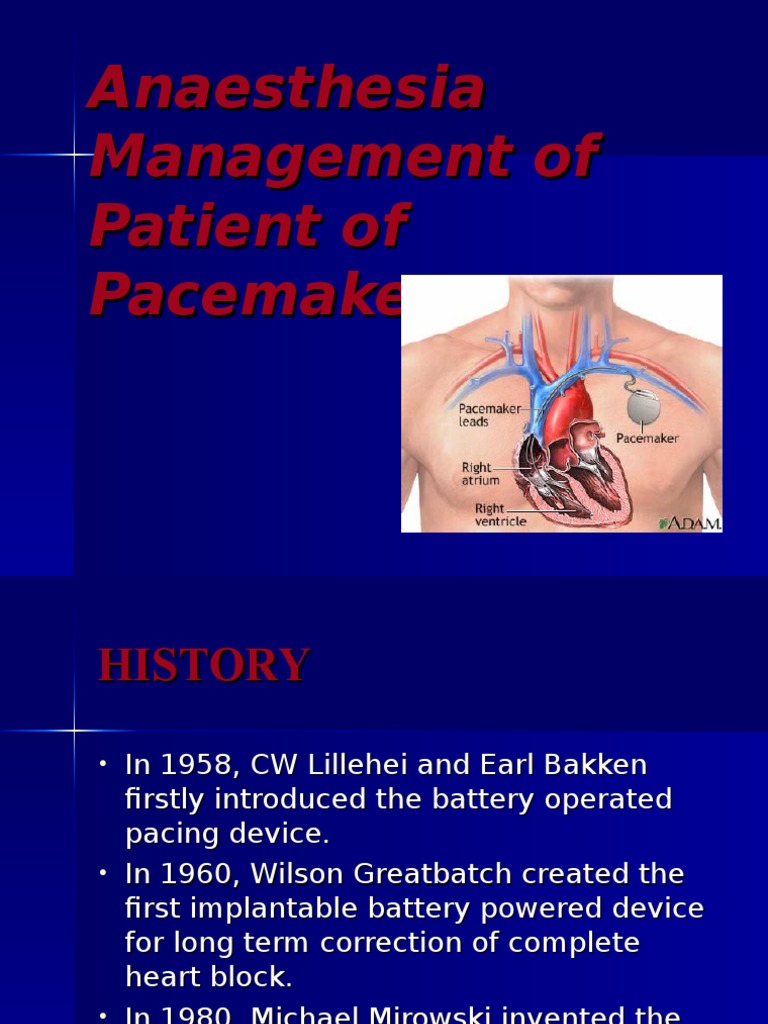 Anaesthesia Management of Patient of Pacemaker | PDF | Artificial ...