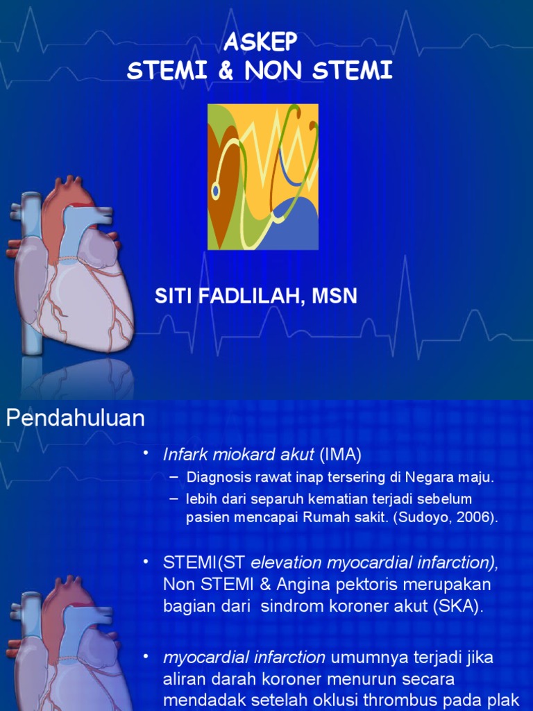 Ami Stemi & Non Stemi | PDF
