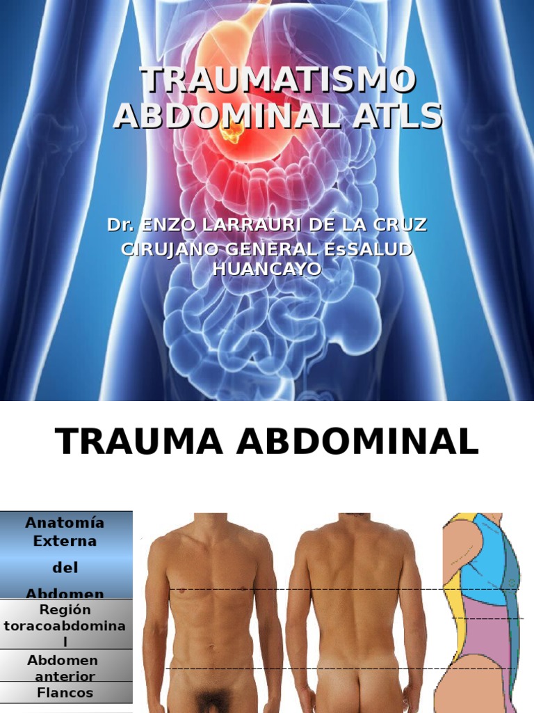 Trauma abdominal ATLS Enzo.ppt