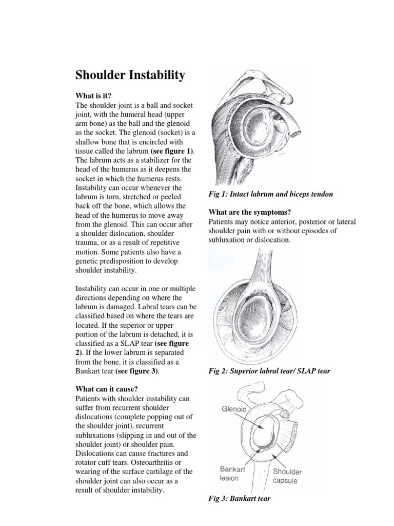 Shoulder Instability: What Is It? | PDF | Shoulder | Anatomical Terms ...