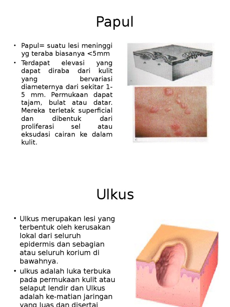 Papul dan Ulkus Kulit | PDF