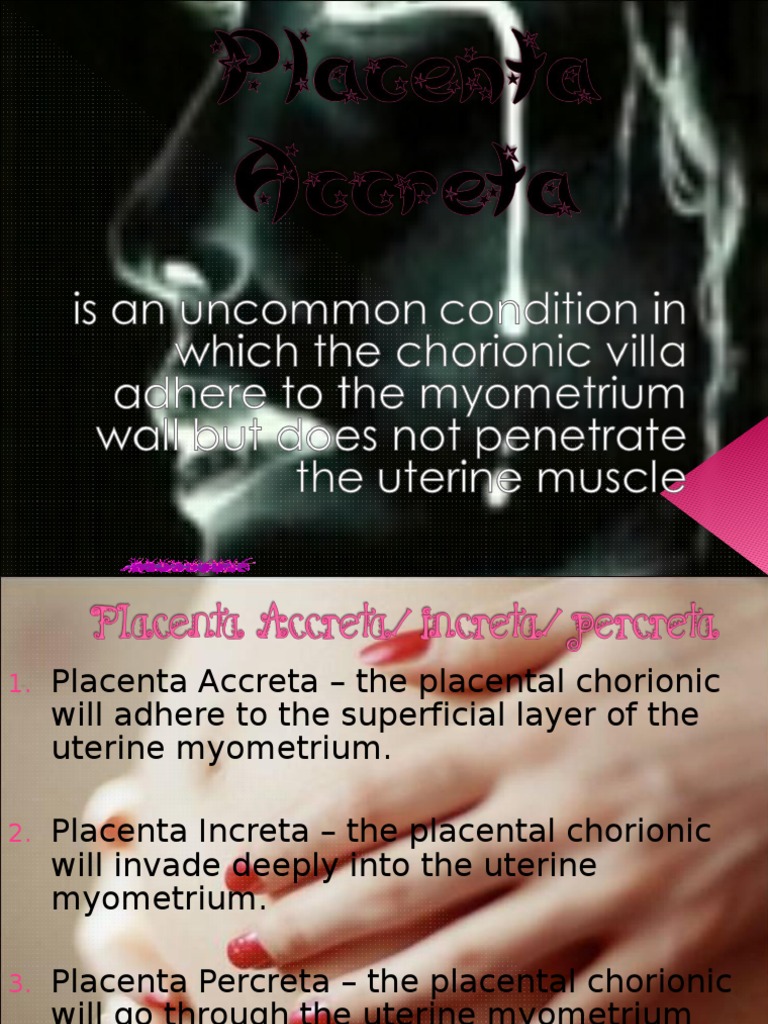 Placenta Accreta Report | PDF | Public Health | Human Pregnancy
