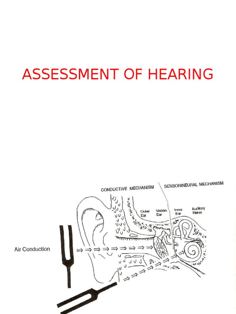 Assessment of Hearing | Download Free PDF | Hearing Loss ...