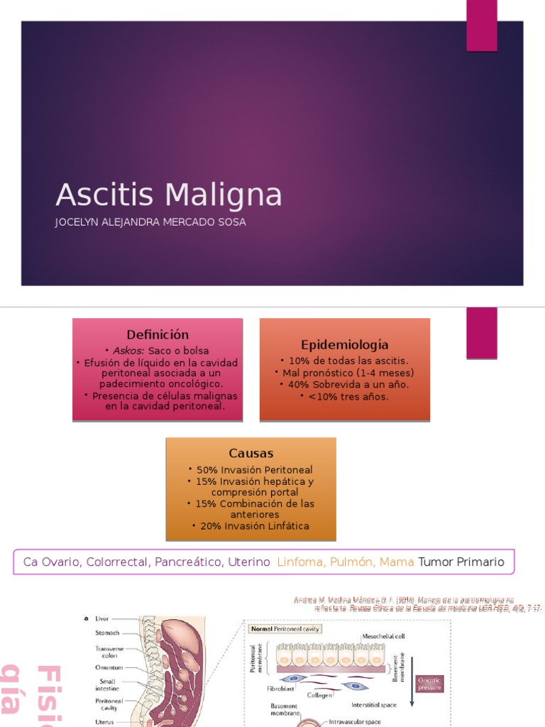 Ascitis Maligna | Biopsia | Cáncer de pulmón