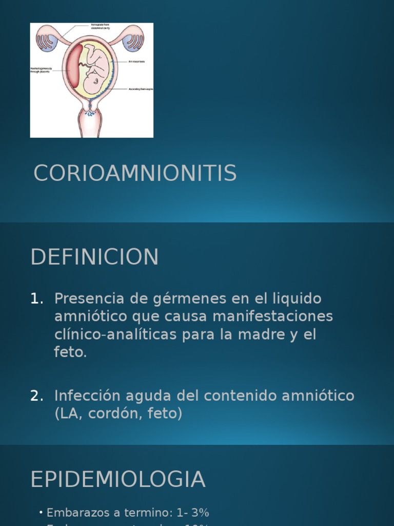 Corioamnionitis | PDF