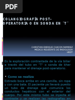 Colangiografía por Sonda T: Guía Completa | PDF | Bilis | Hígado