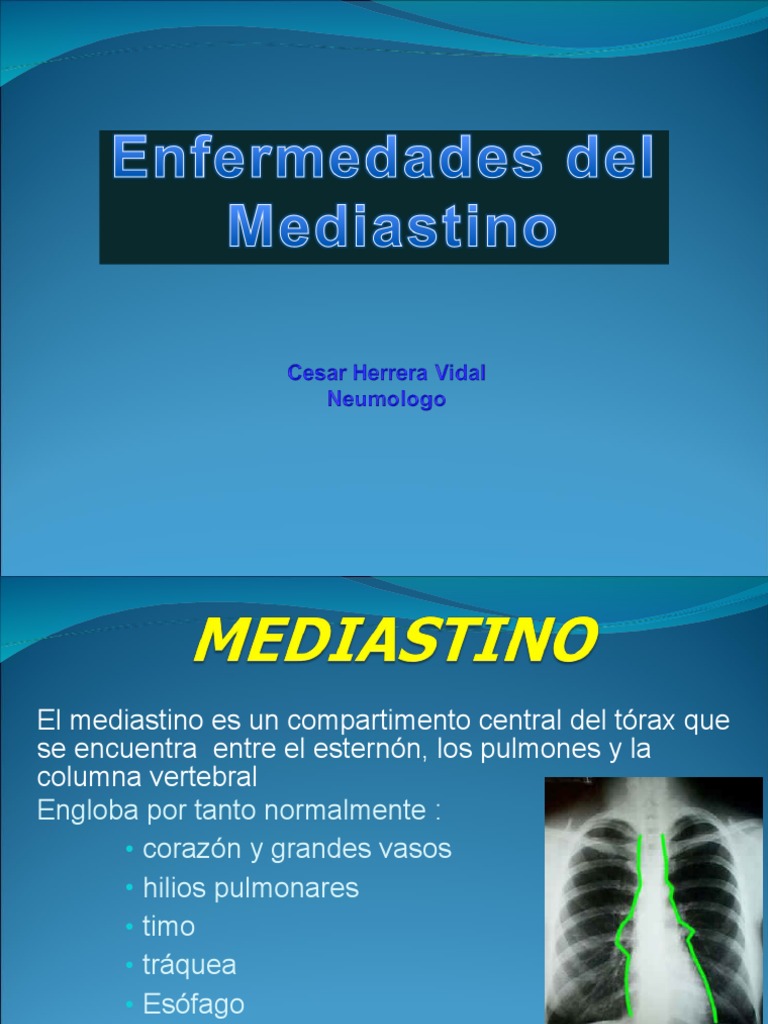 02 Patologia Del Mediastino | PDF | Tórax (anatomía humana) | Enfermedades y trastornos