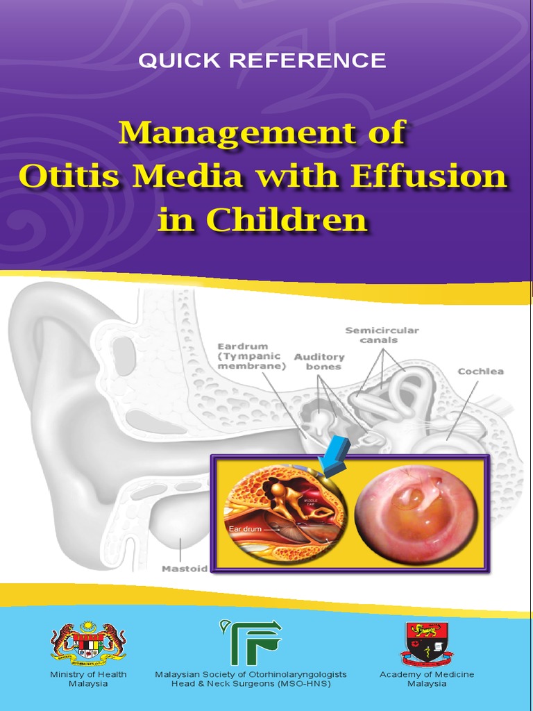 Management of Otitis Media With Effusion in Children: Quick Reference | PDF