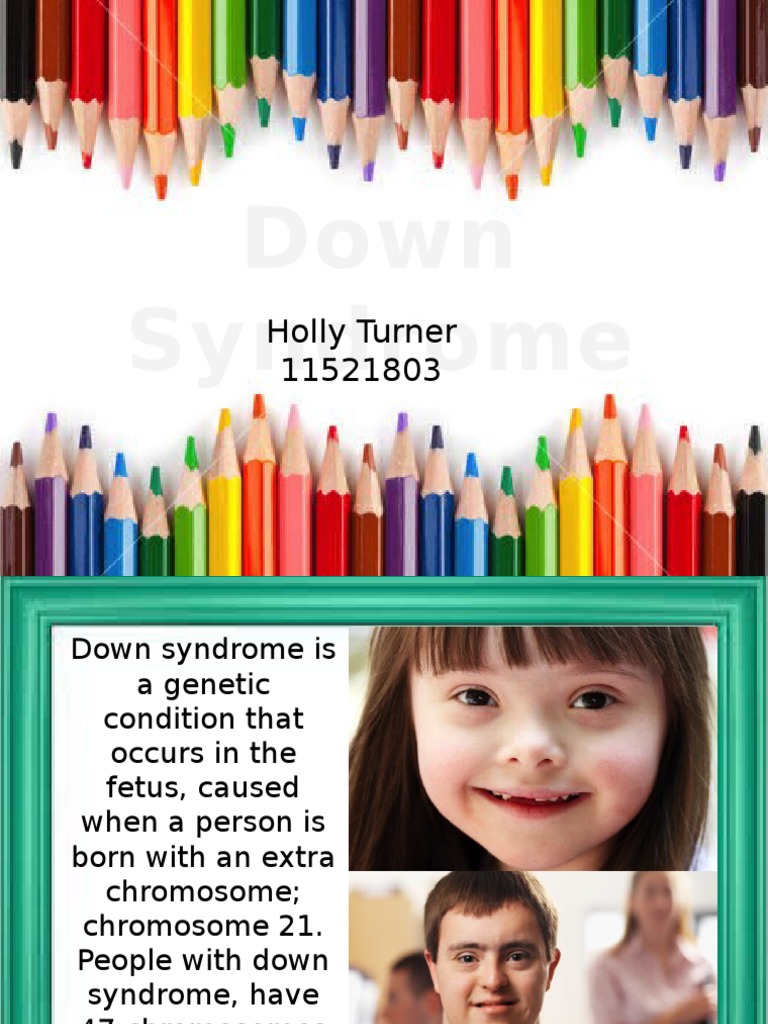 Down Syndrome | PDF | Down Syndrome | Diseases And Disorders