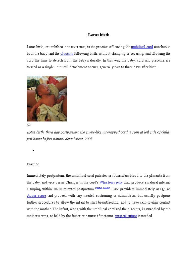 Lotus Birth: Umbilical Cord Placenta | PDF