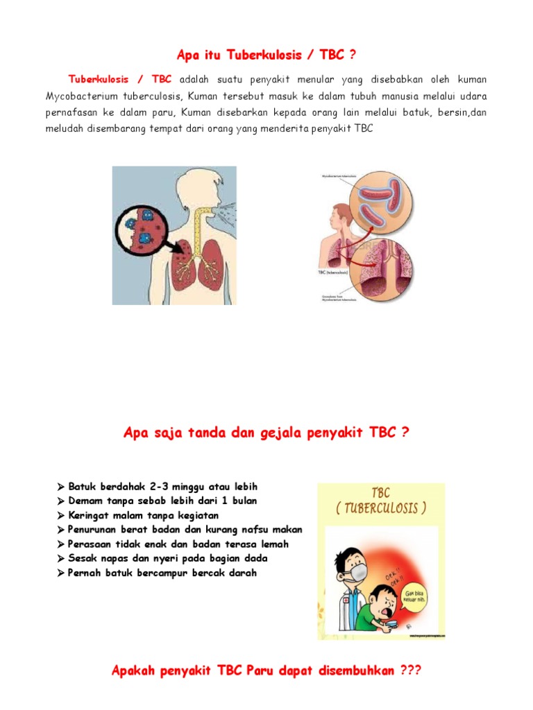 Lembar Balik TB (Tuberkulosis) | PDF | Sains & Matematika | Gaya Hidup