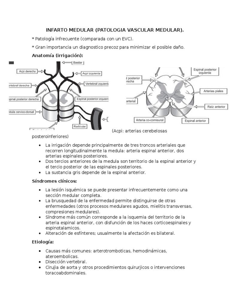Infarto Medular 1 | PDF