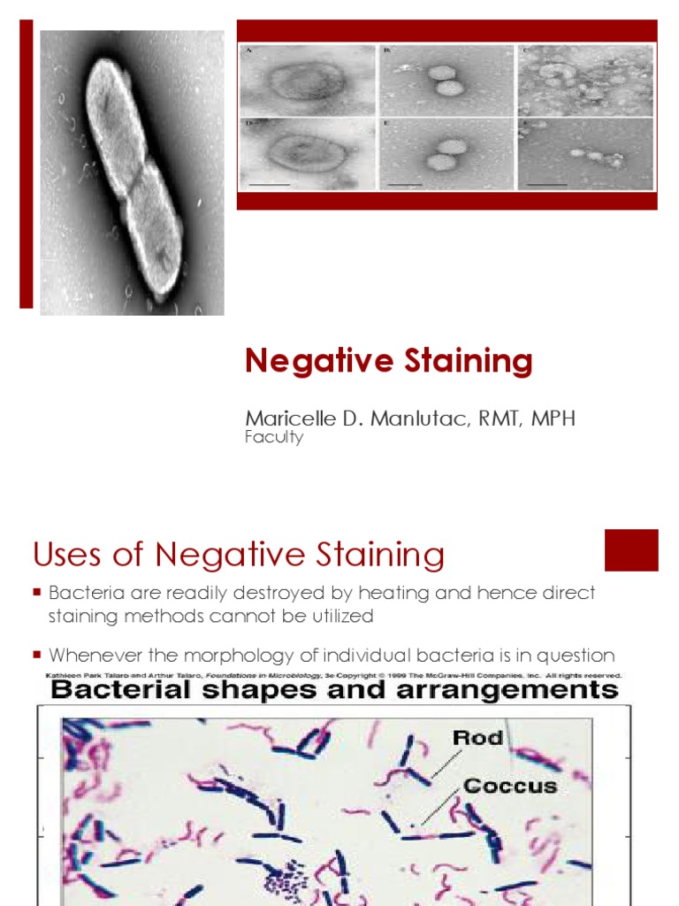 Negative Special and Living Bacteria Motility Maricelle Manlutac | PDF | Staining | Bacteria