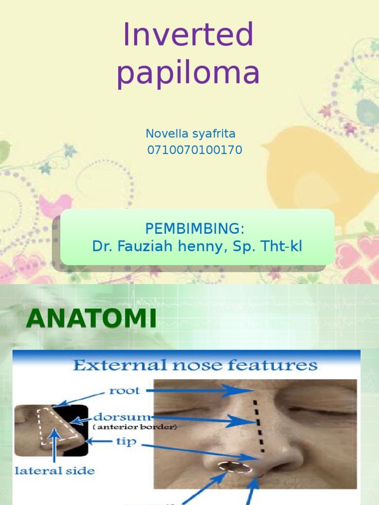 Anatomy and Treatment of Inverted Papilloma | PDF