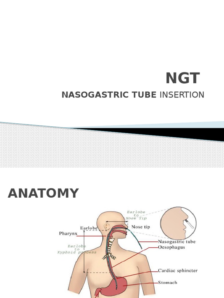 Nasogastric Tube Insertion | PDF | Medical Specialties | Gastroenterology