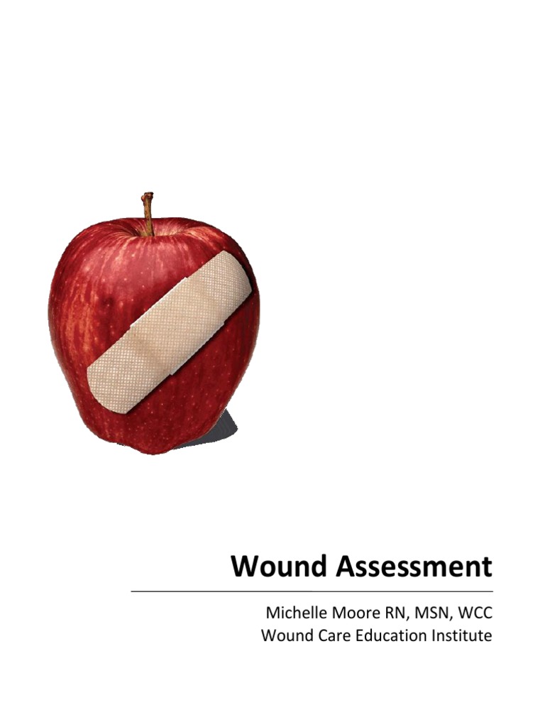 Wound Assessment: Michelle Moore RN, MSN, WCC Wound Care Education ...