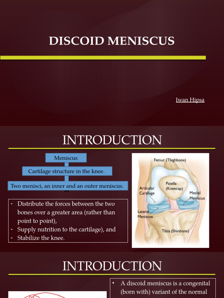 Discoid Meniscus | PDF | Knee | Diseases And Disorders