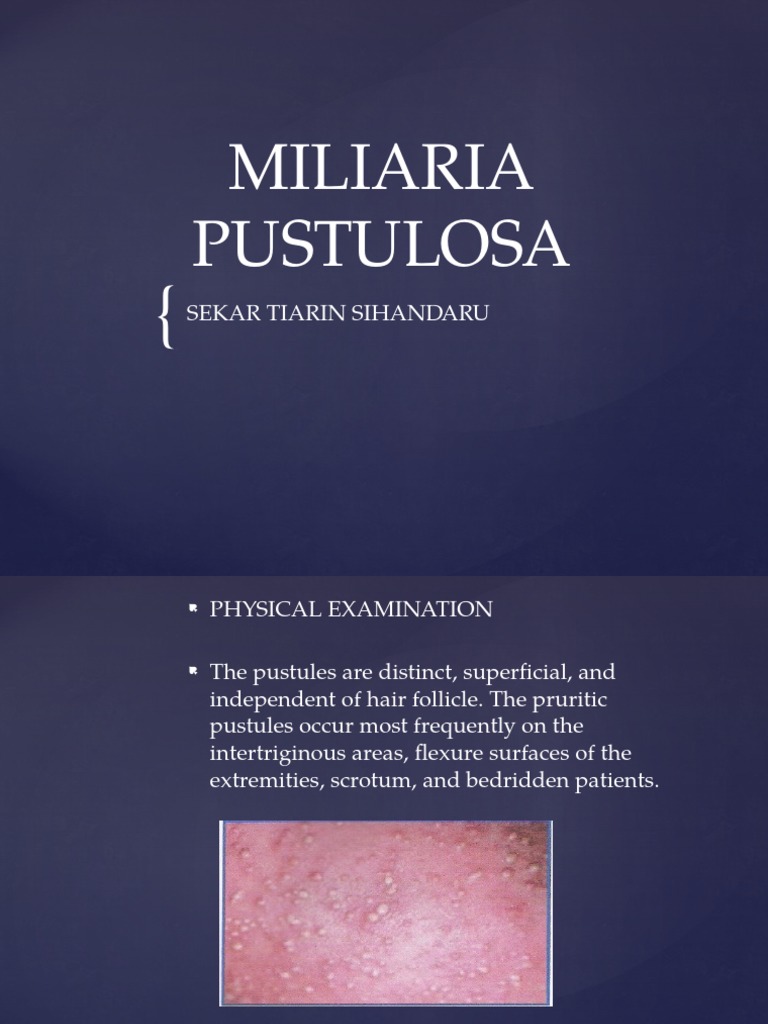 Miliaria Pustulosa TB | PDF