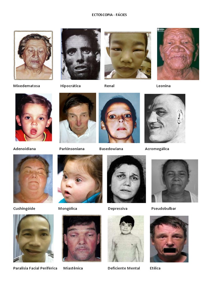 Tipos de Fácies na Ectoscopia | PDF