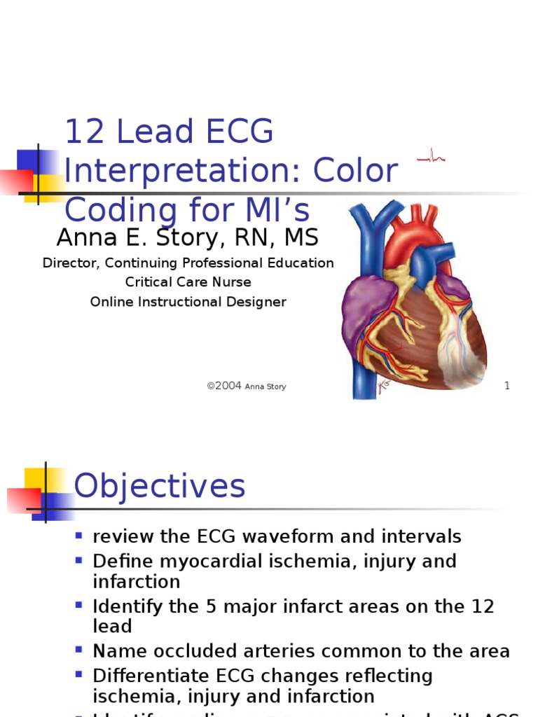 12 Lead ECG Color Codes 1_04(1) | Electrocardiography | Cardiology