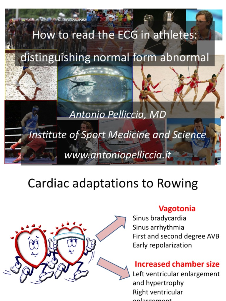How To Read The ECG in Athletes: Distinguishing Normal Form Abnormal ...