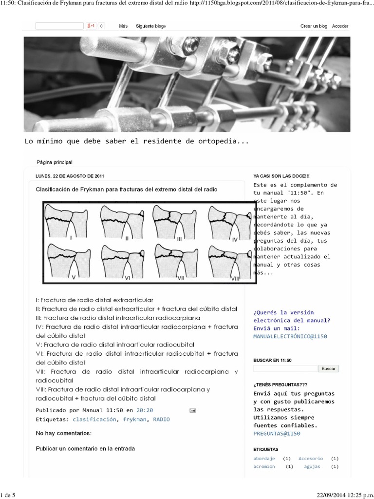 11_50_ Clasificación de Frykman para fracturas del extremo distal del ...
