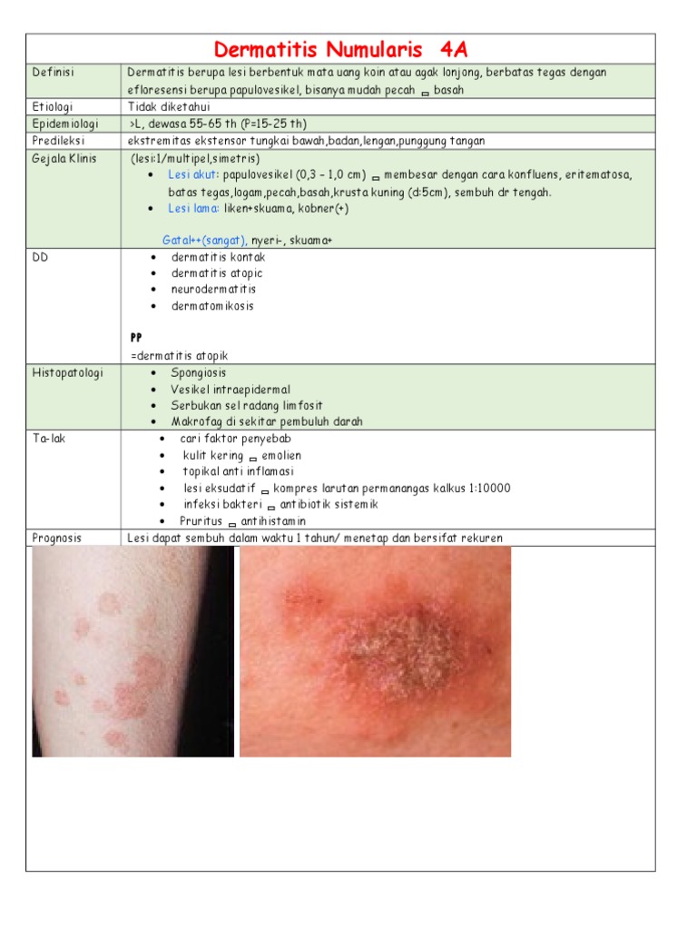 Dermatitis Numularis Print | PDF
