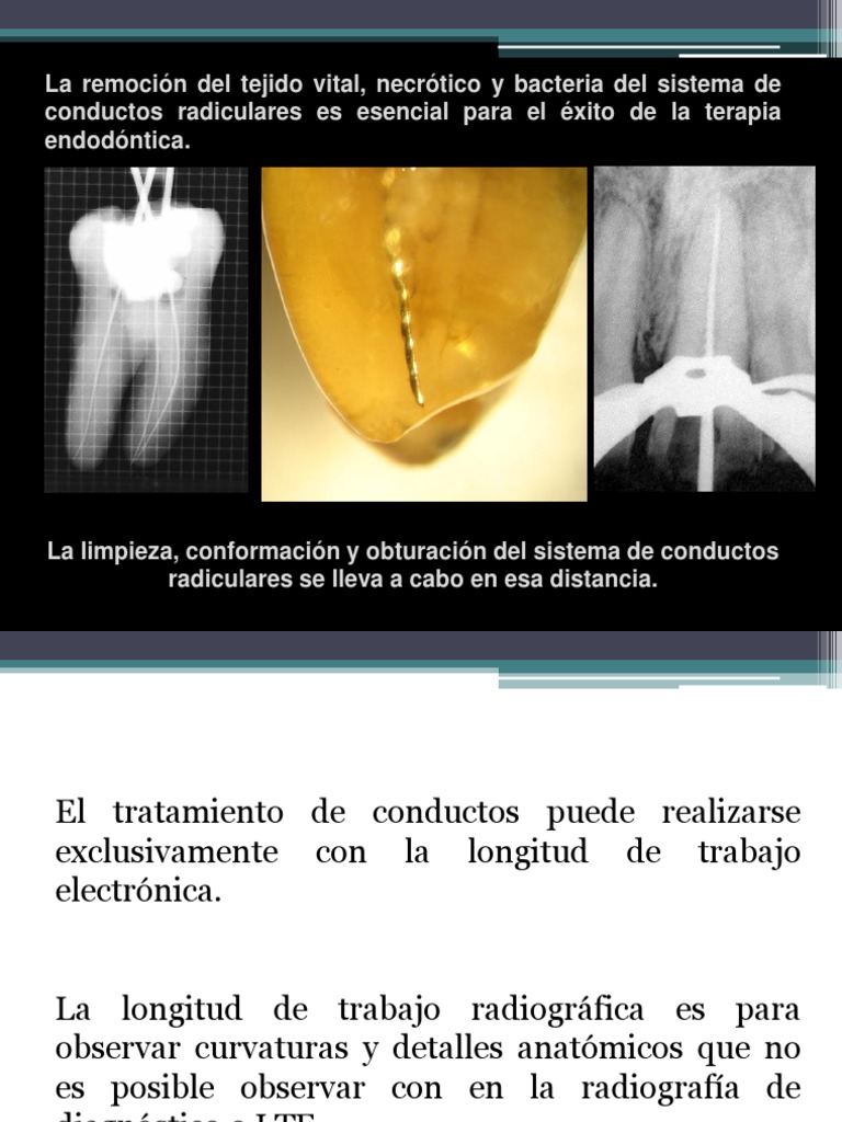 Conductometría Principios y Fundamentos para El Tratamiento Endodóntico ...