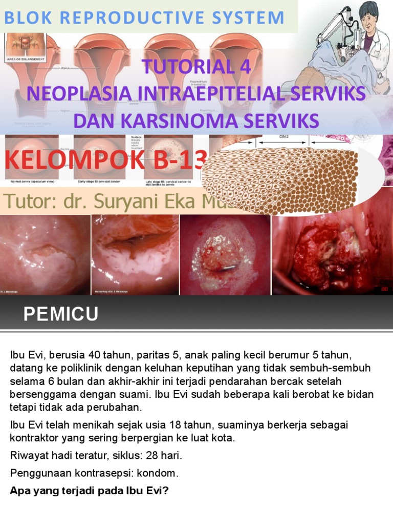 Kanker Serviks | PDF